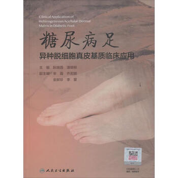 糖尿病足异种脱细胞真皮基质临床应用