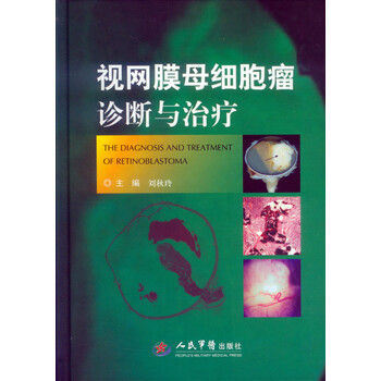 视网膜母细胞瘤诊断与治疗