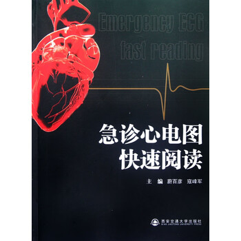 急诊心电图快速阅读