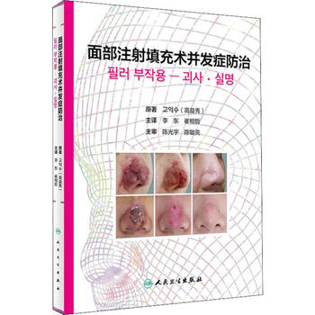 面部注射填充术并发症防治