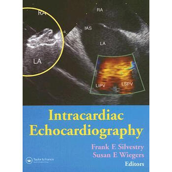 Intracardiac Echocardiography