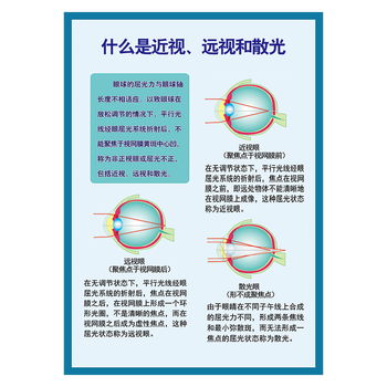 近视宣传画海报挂图保护视力远视表远视图眼睛视力训练图墙贴画覆膜贴纸SCH WST25 近视远视 80*60厘米 PP覆膜贴纸