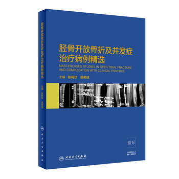 胫骨开放骨折及并发症治疗病例精选