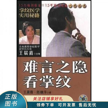 难言之隐看掌纹 王晨霞