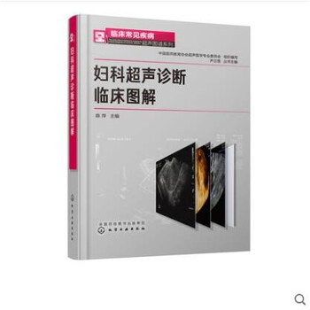 妇科超声诊断临床图解