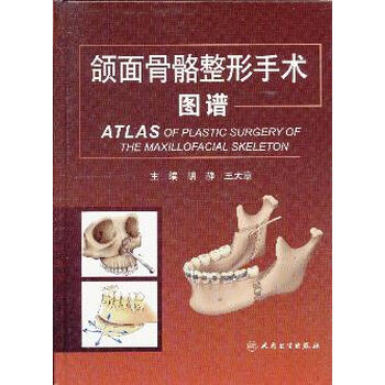 颌面骨骼整形手术图谱