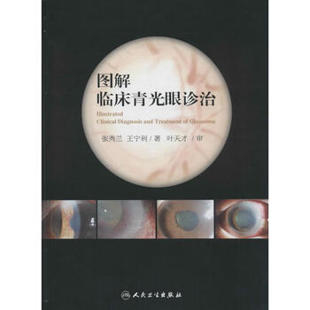 图解临床青光眼诊治