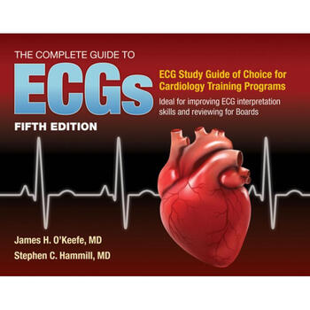 The Complete Guide to Ecgs: A Comprehensive ...