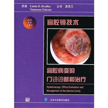 宫腔镜技术宫腔病变的门诊诊断和治疗（E)