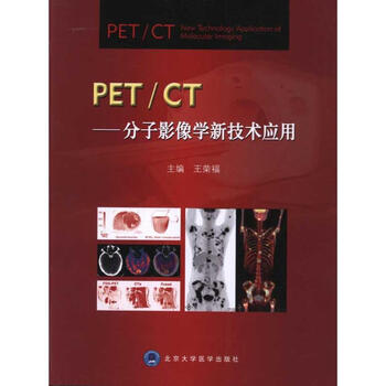 PET/CT:分子影像学新技术应用