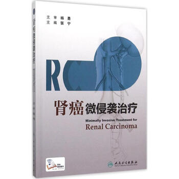 肾癌微侵袭治疗