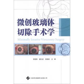 微创玻璃体切除手术学