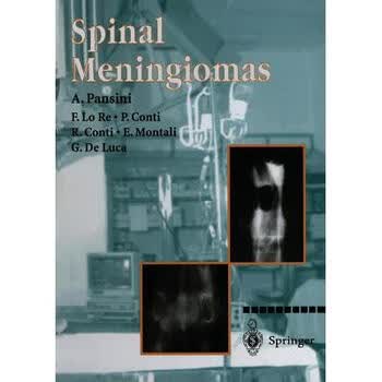Spinal Meningiomas