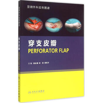 穿支皮瓣