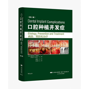 口腔种植并发症 病因、预防和治疗 第二版