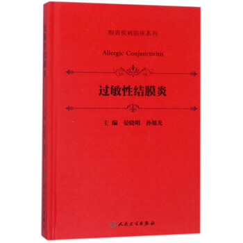 过敏性结膜炎(精)/眼表疾病临床系列
