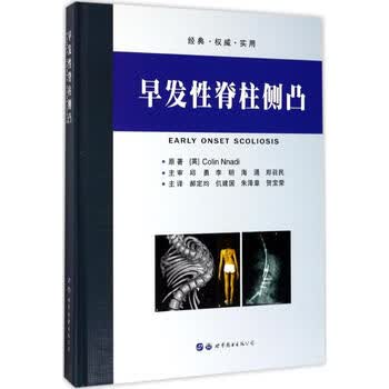 早发性脊柱侧凸
