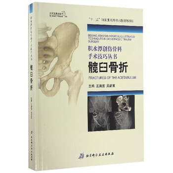 髋臼骨折(精)/积水潭创伤骨科手术技巧丛书