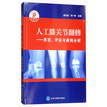 人工膝关节翻修：原因、评估与病例分析