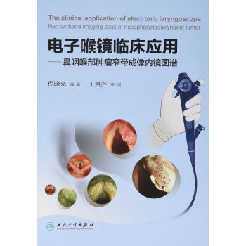 电子喉镜临床应用·鼻咽喉部肿瘤窄带成像内镜图谱(配增值)