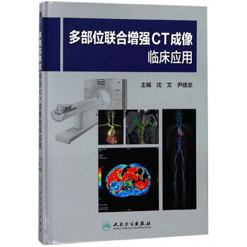多部位联合增强CT成像临床应用(精)