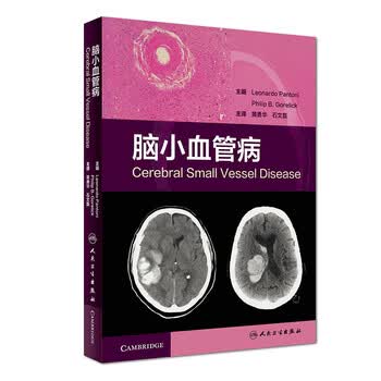 脑小血管病
