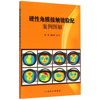 硬性角膜接触镜验配案例图解