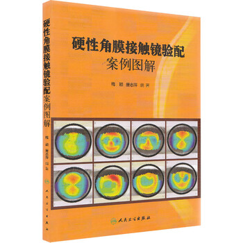 硬性角膜接触镜验配案例图解 梅颖 唐志萍