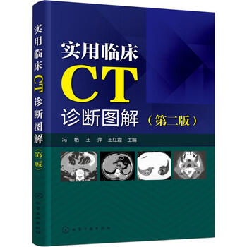 实用临床CT诊断图解(第2版)
