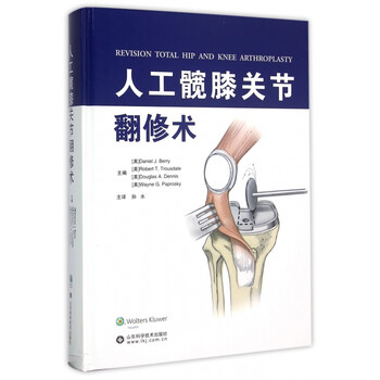 人工髋膝关节翻修术(精)