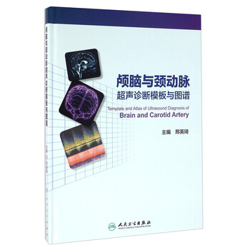颅脑与颈动脉超声诊断模板与图谱