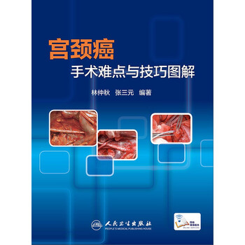 宫颈癌手术难点与技巧图解