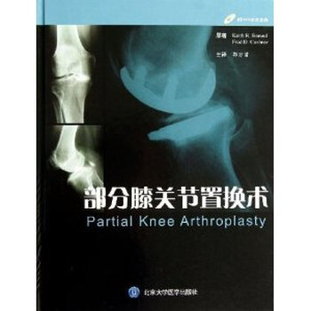 部分膝关节置换术（附DVD）