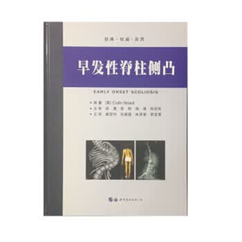 早发性脊柱侧凸